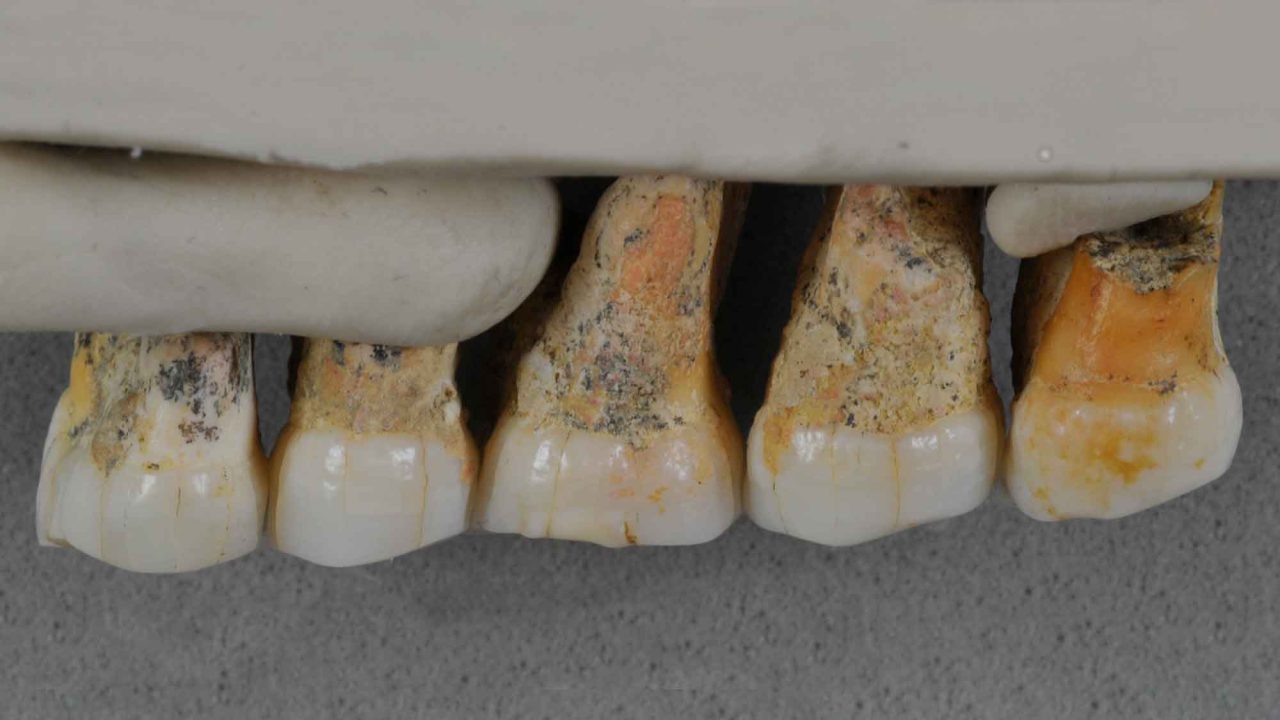 New Hominin Shakes the Family Tree—Again – SAPIENS